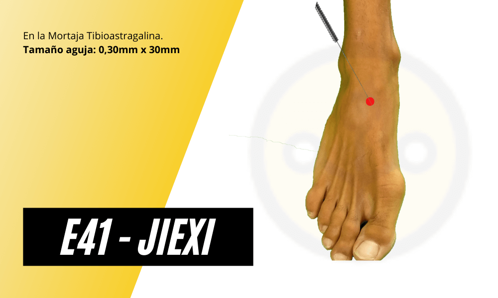 Esguinces tobillo y ElectroNeuroAcupuntura | Tempo Formación